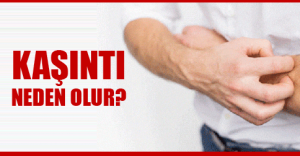 Kaşıntı Neden Olur? – Kaşıntı Nedenleri